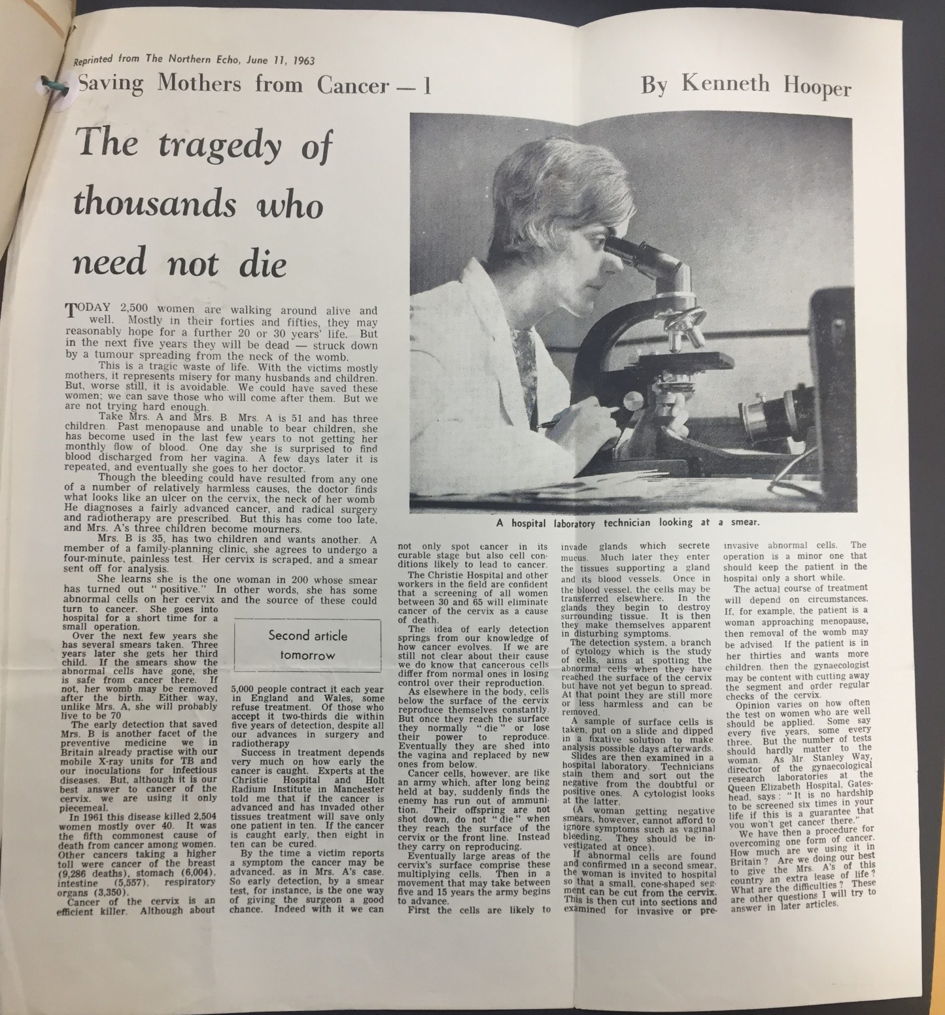 'Peace to millions of women': A history of the cervical smear test ...