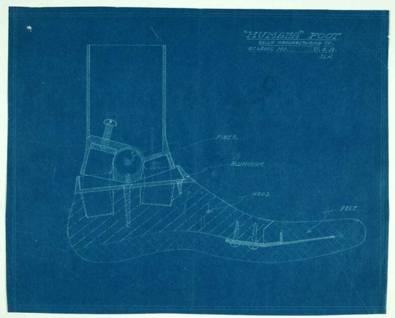 Manufacturing artificial limbs during the First World War - The ...
